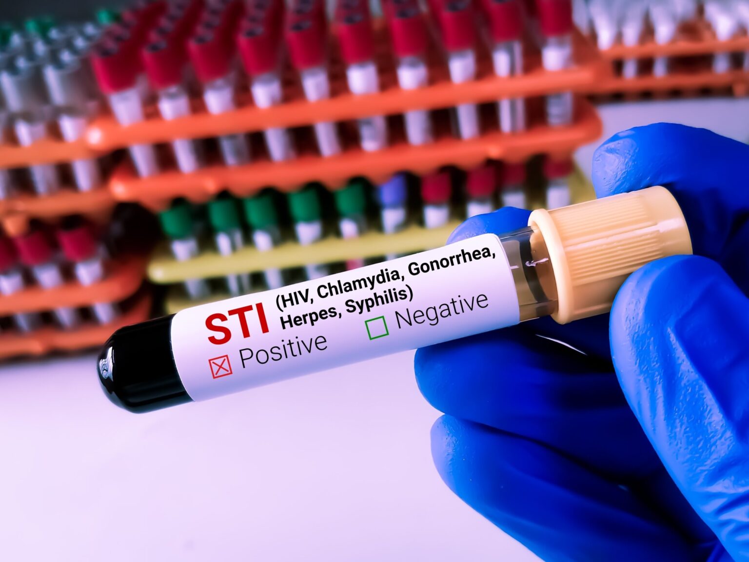 MEN’S HEALTH CENTER: THE PREMIER CHOICE FOR STI TREATMENT IN HO CHI ...